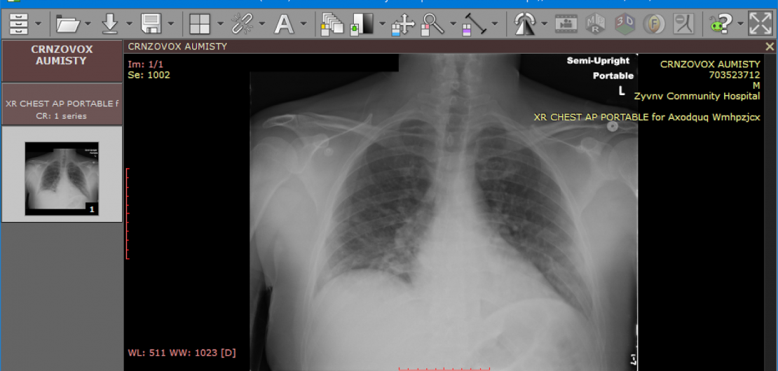 Masking PHI in DICOM Files - IRI